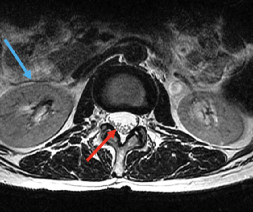 How Covera Health Works