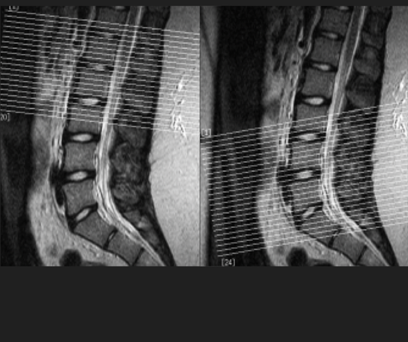 How Covera Health Works